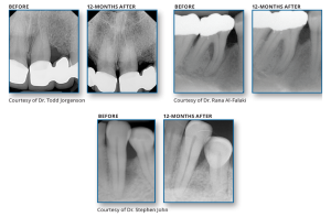 REPAIR Perio Protocol Guidebook | Waterlase Dentistry