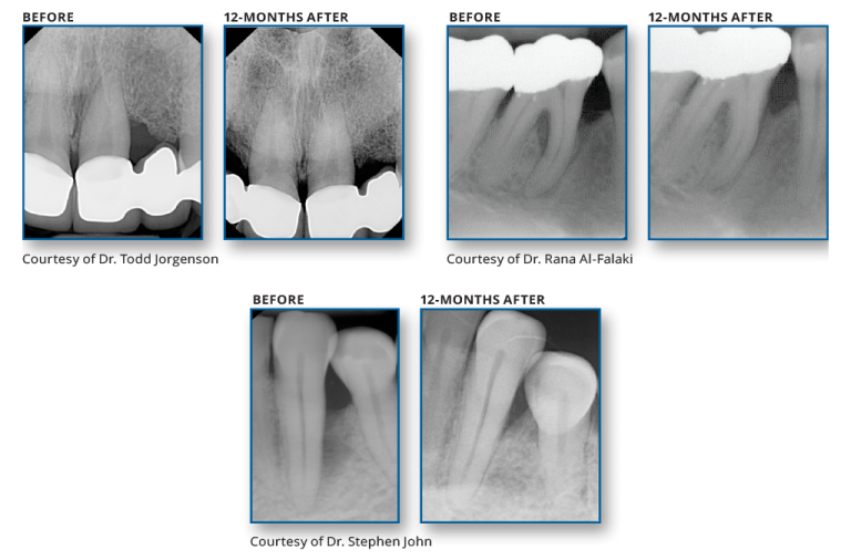 REPAIR Perio Protocol Guidebook | Waterlase Dentistry