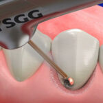 BIOLASE Dental Lasers | Global Leadership in Dentistry