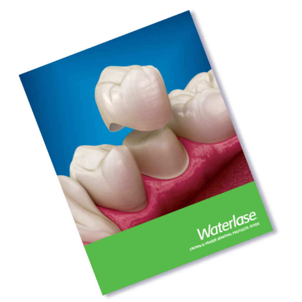 Crown & Veneer Removal with Waterlase Dental Laser | BIOLASE