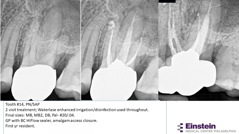 Making an Impact: Our Experience with Dental Lasers at Einstein’s ...