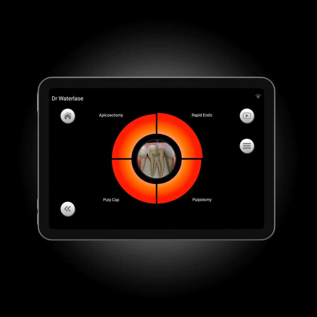 Root Canals and Waterlase Endodontics | BIOLASE