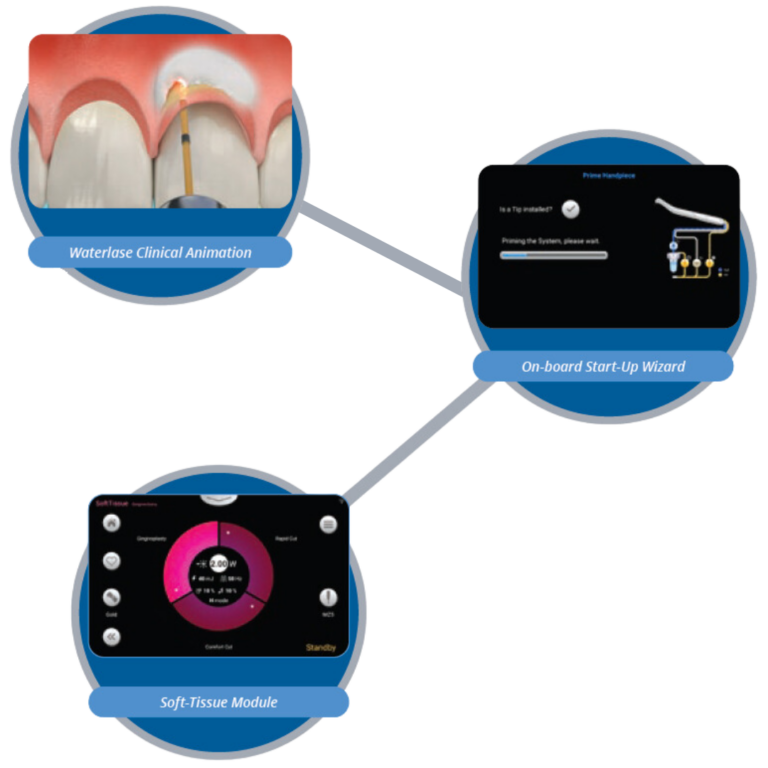 Waterlase iPlus - All Tissue Dental Laser | BIOLASE
