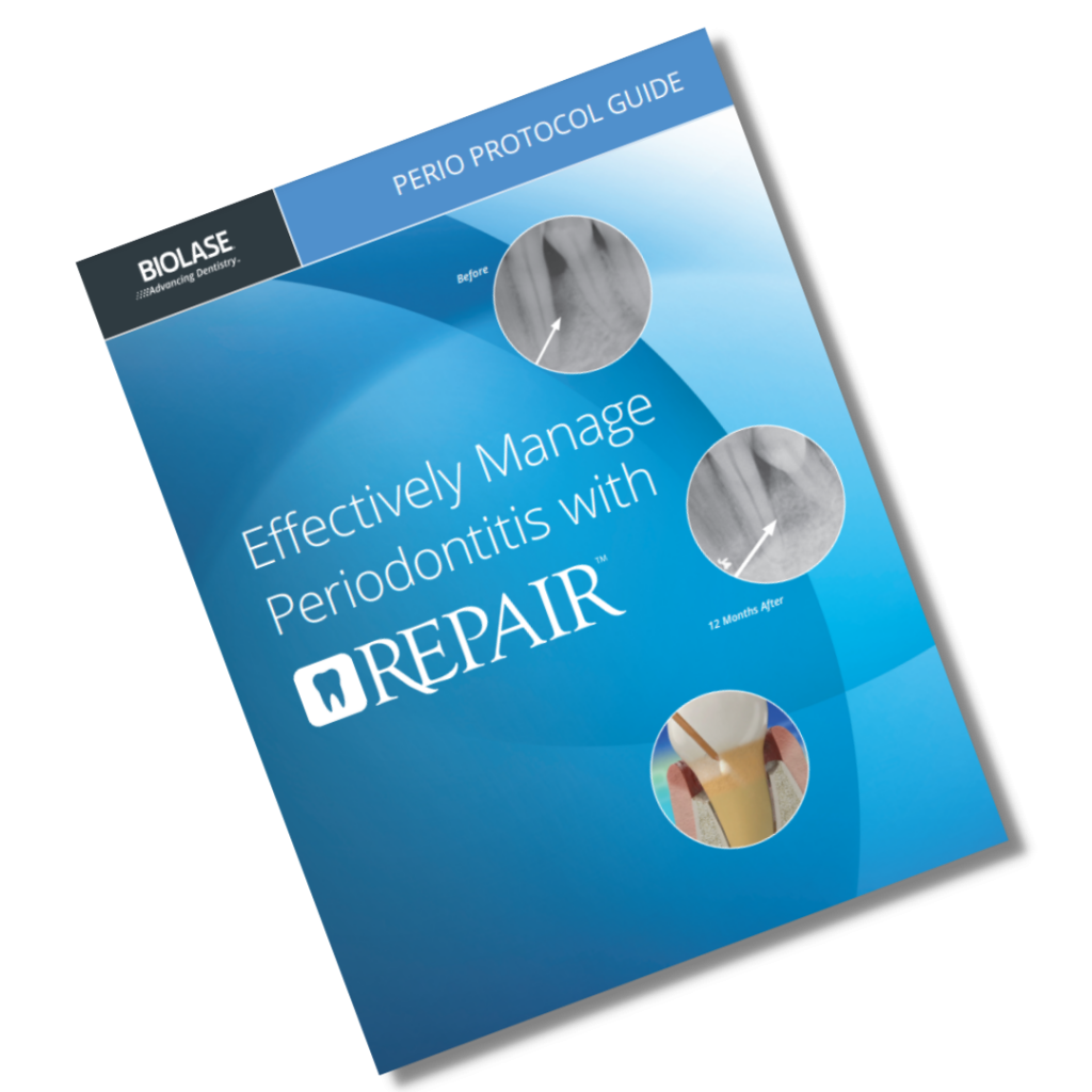 Periodontitis Treatment with Waterlase Lasers | BIOLASE
